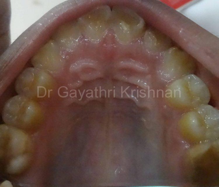 Clinical Cases Archive - Dr Gayathri Krishnan